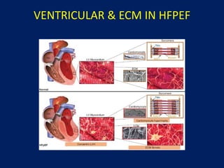 Heart Failure : what is new by Dr. Vaibhav Yawalkar MD DM Cardiology ...