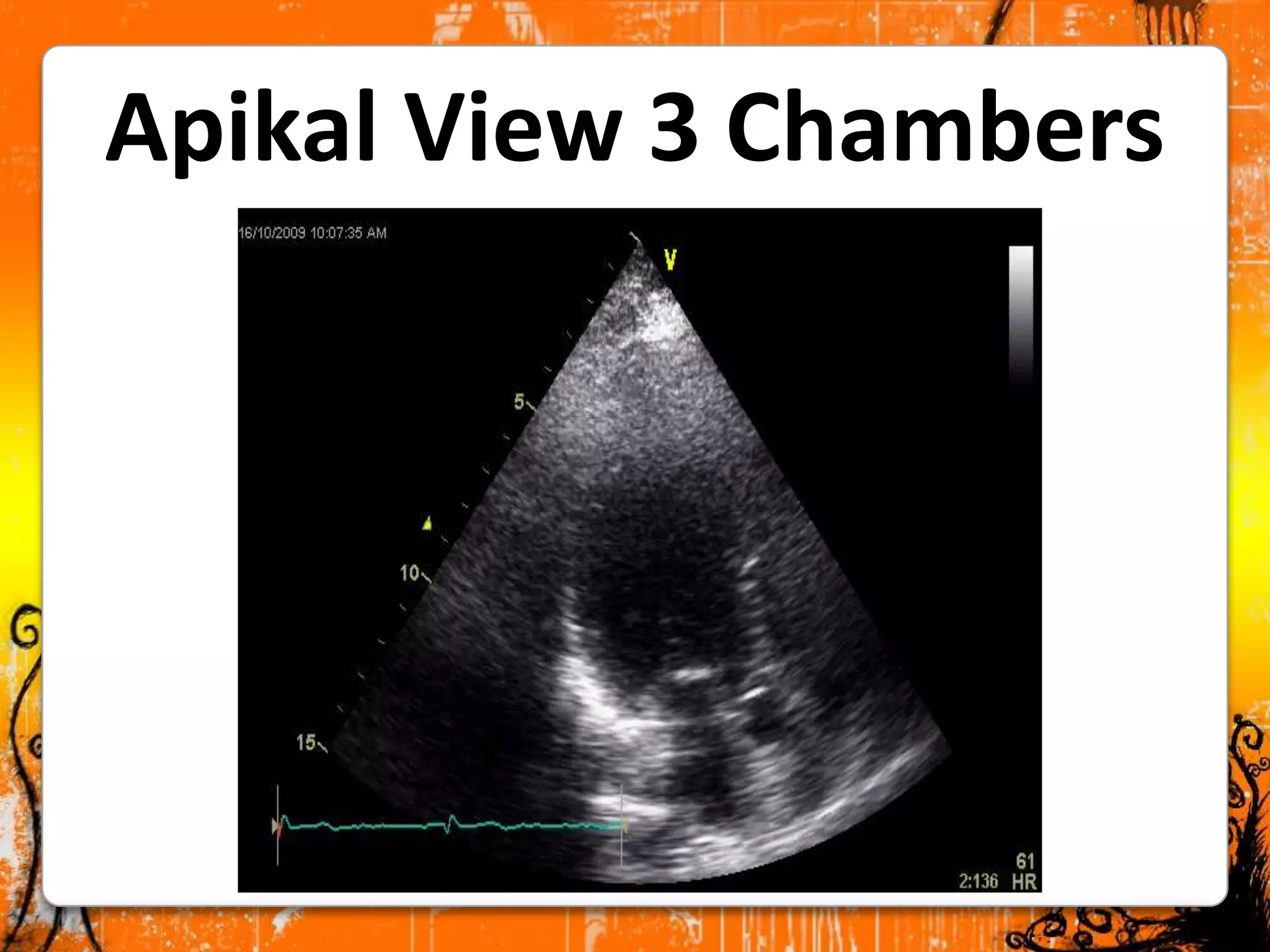 Apikal view,subcostal view,dan supra sternal view | PPT