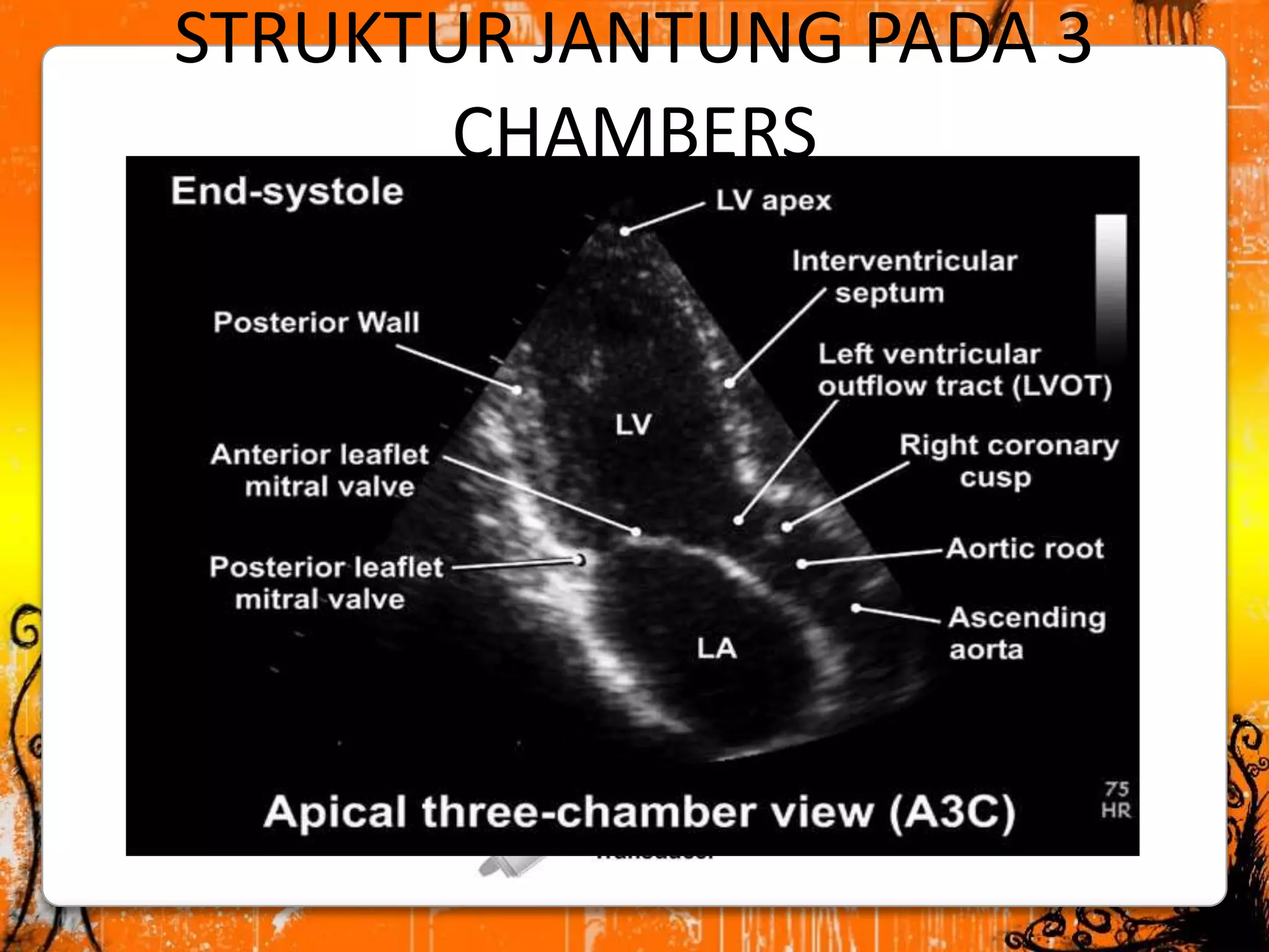 Apikal view,subcostal view,dan supra sternal view | PPT
