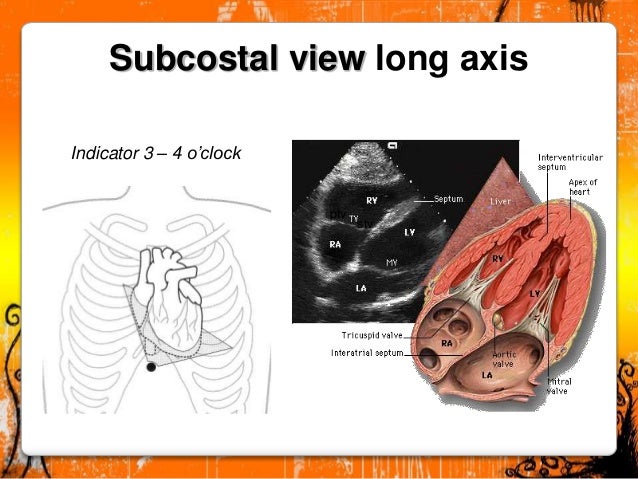 Apikal view,subcostal view,dan supra sternal view