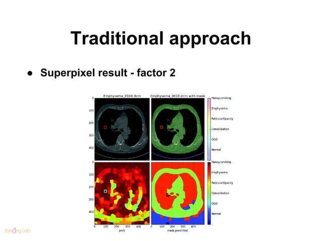 A pixel to-pixel segmentation method of DILD without masks using CNN ...