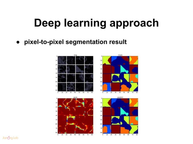 A pixel to-pixel segmentation method of DILD without masks using CNN ...