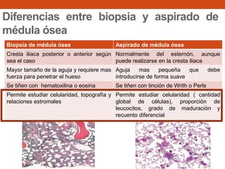 Aplasia medular | PDF