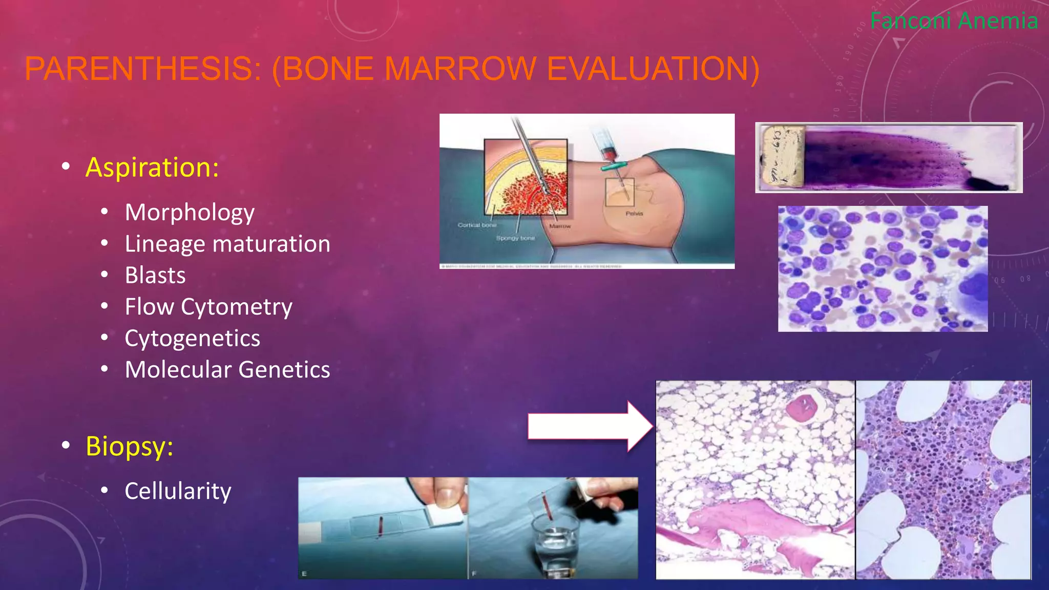 Aplastic anemia | PPSX