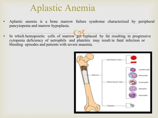 Aplastic Anaemia | PPTX