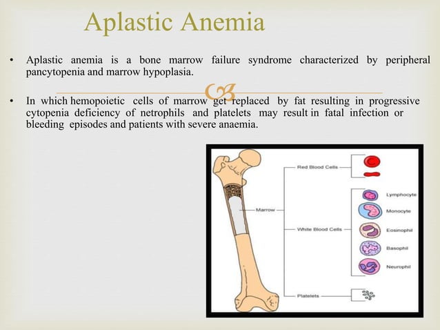 Aplastic Anaemia | PPTX | Blood Disorders | Diseases and Conditions