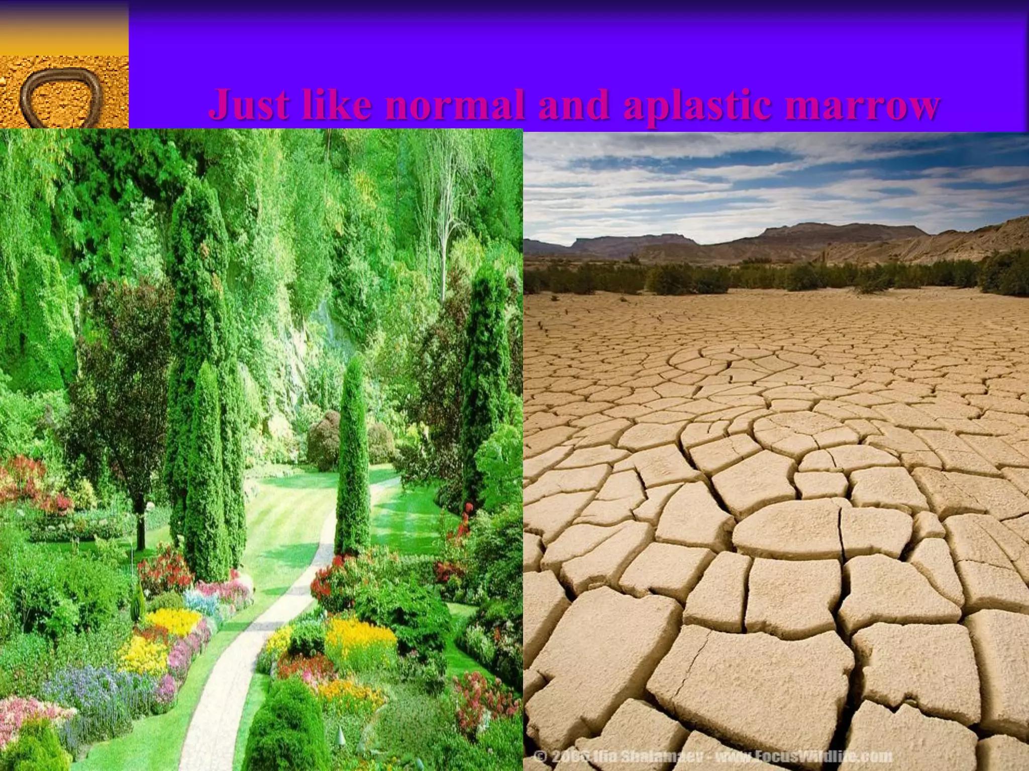 Aplastic Anemia Ppt