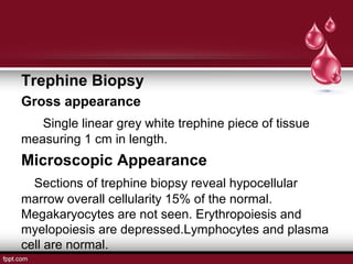 Aplastic anemia | PPT