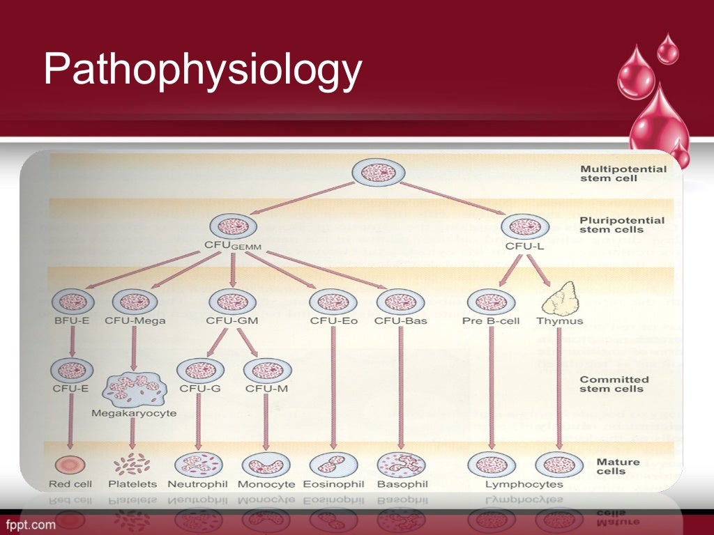 Aplastic Anemia