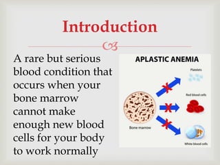 aplastic anemia.pptx