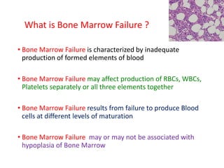 Aplastic Anemia Bone Marrow