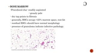 aplastic anemia power point presentation | PPTX