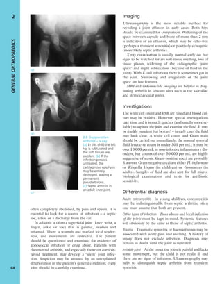 Apley's shoulderjt examination | PDF