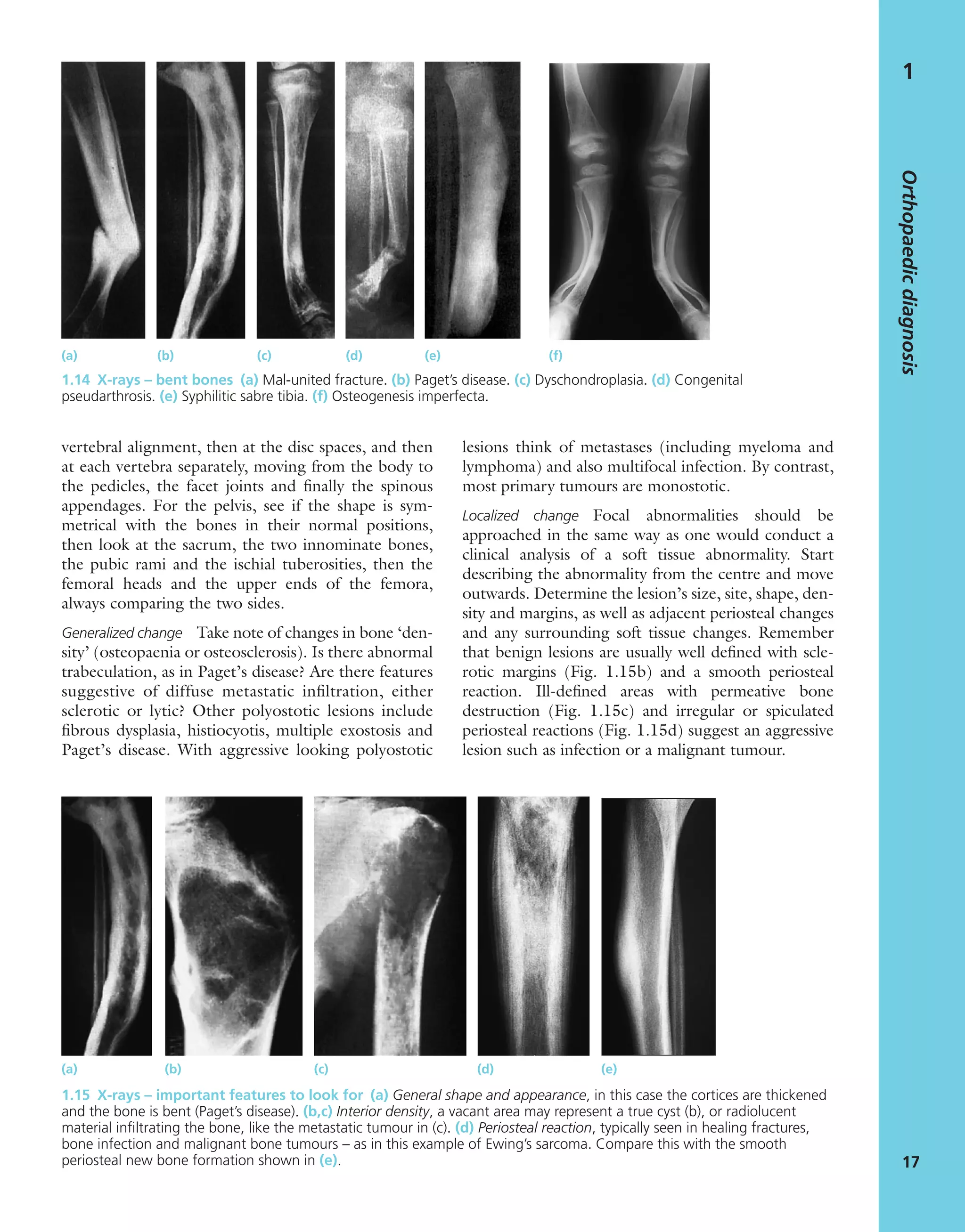 Apley's system of orthopaedics and fractures 9th ed | PDF