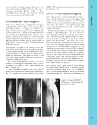 Apley's system of orthopaedics and fractures 9th ed | PDF