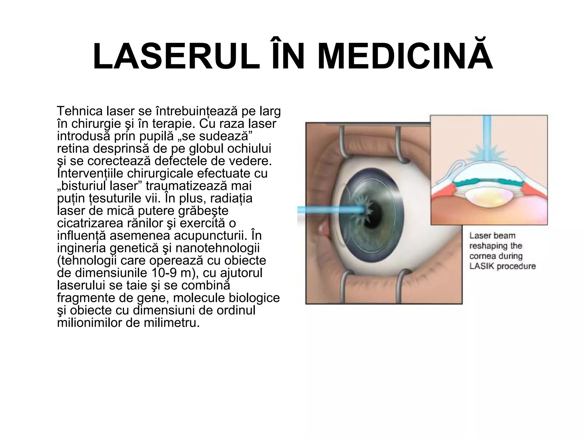 Aplicatii Ale Laserelor | PPT
