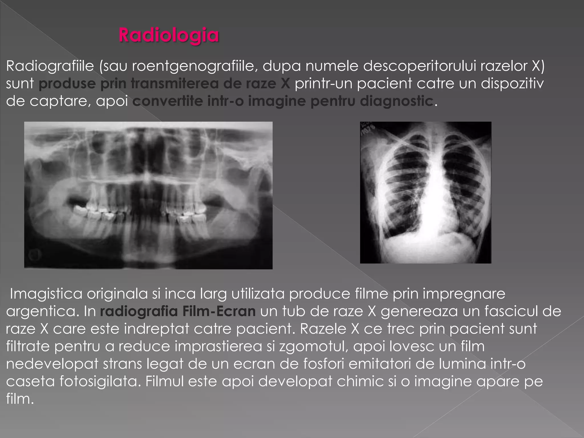 Aplicatii radiatiile x | PPTX