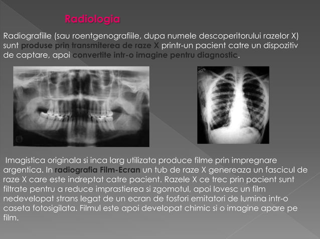 Aplicatii radiatiile x | PPTX