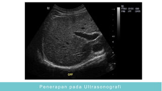 Aplikasi fourier dalam usg | PPT