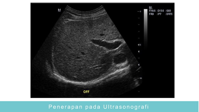 Aplikasi fourier dalam usg | PPT