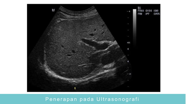 Aplikasi fourier dalam usg | PPT
