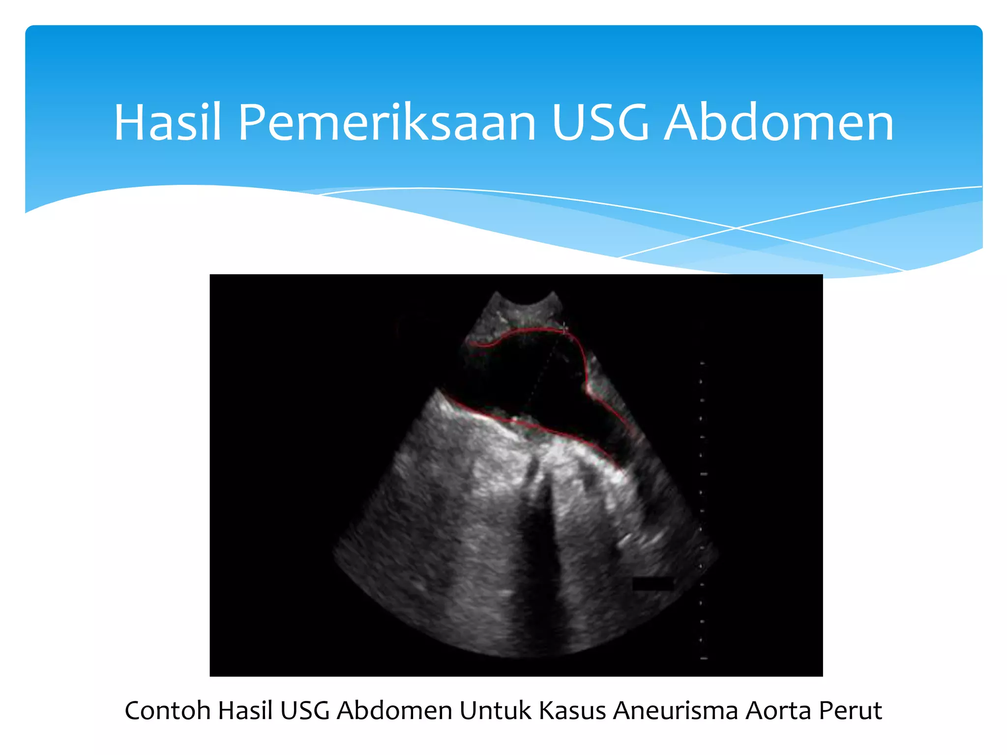 Aplikasi Klinik USG | PPTX