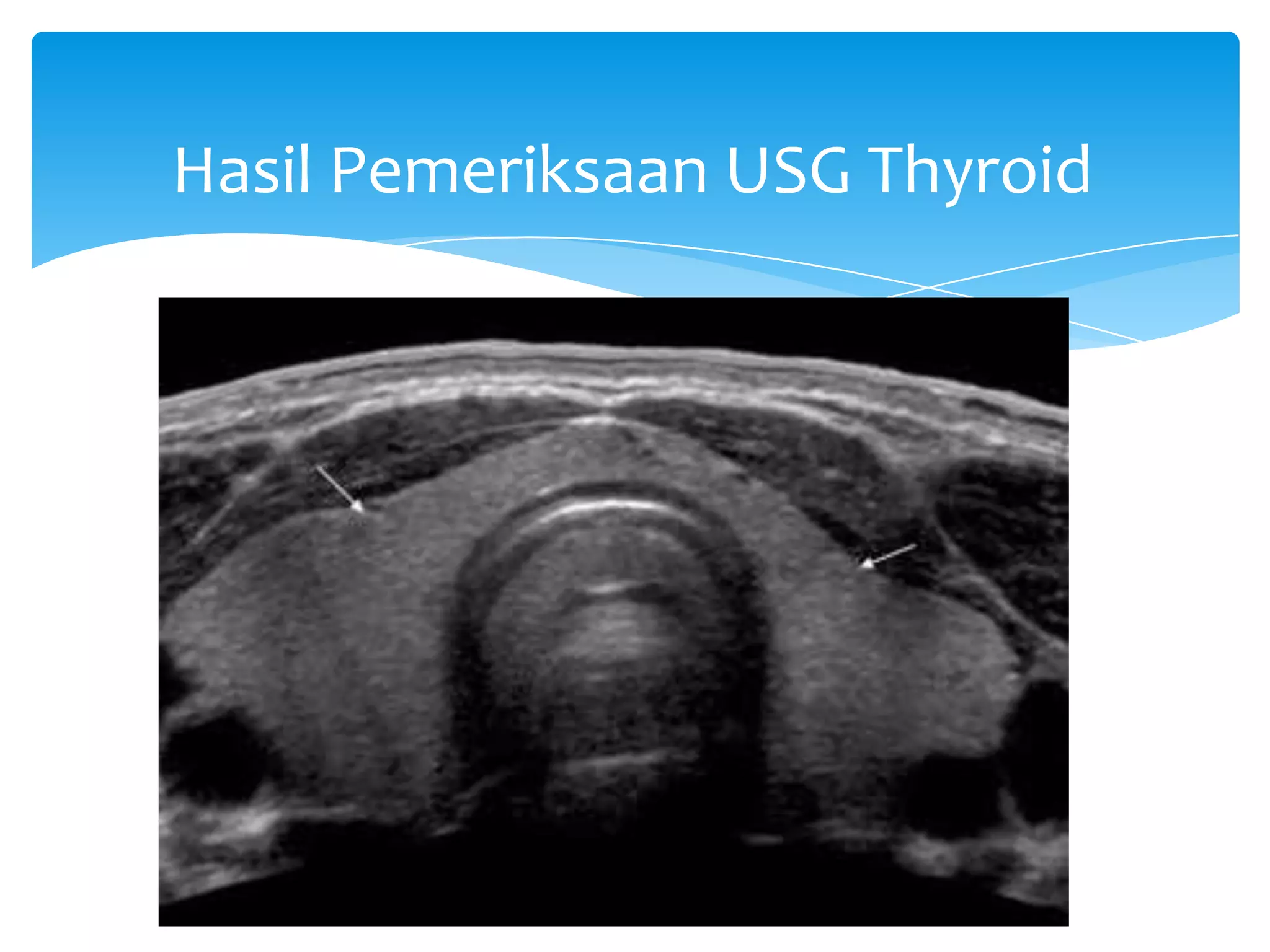 Aplikasi Klinik USG | PPTX