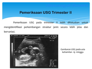 Aplikasi Klinik USG | PPT