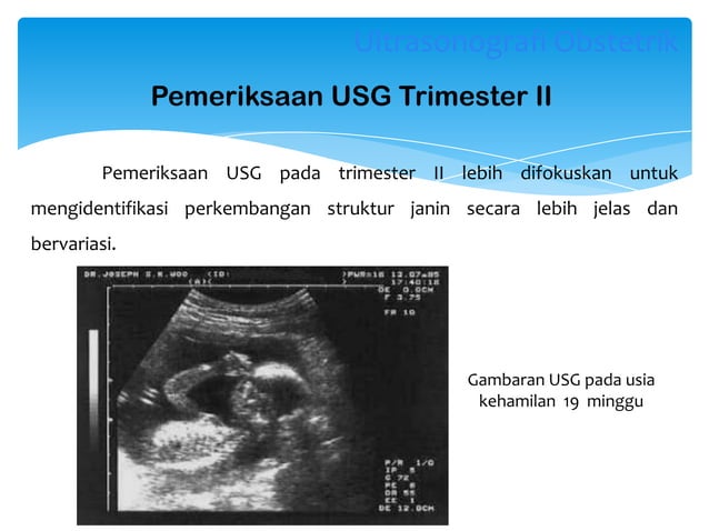 Aplikasi Klinik USG | PPT