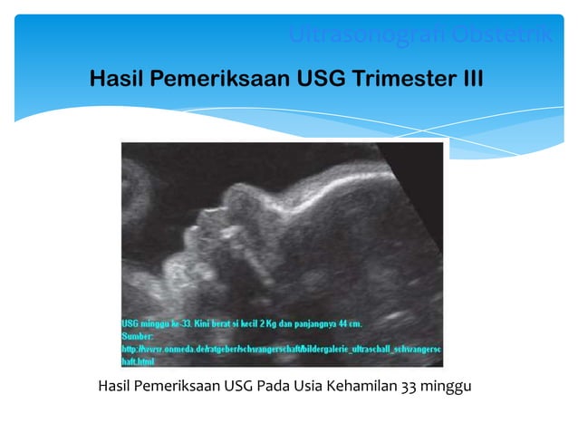 Aplikasi Klinik USG | PPT