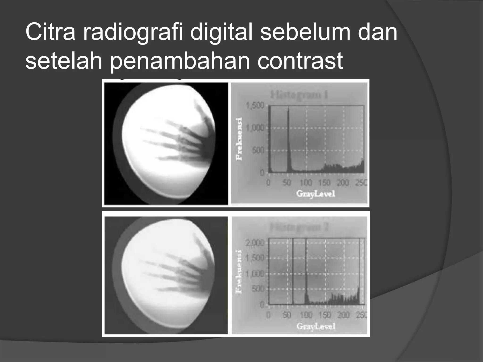 ppt Aplikasi pengolahan citra digital pada modalitas digital ...