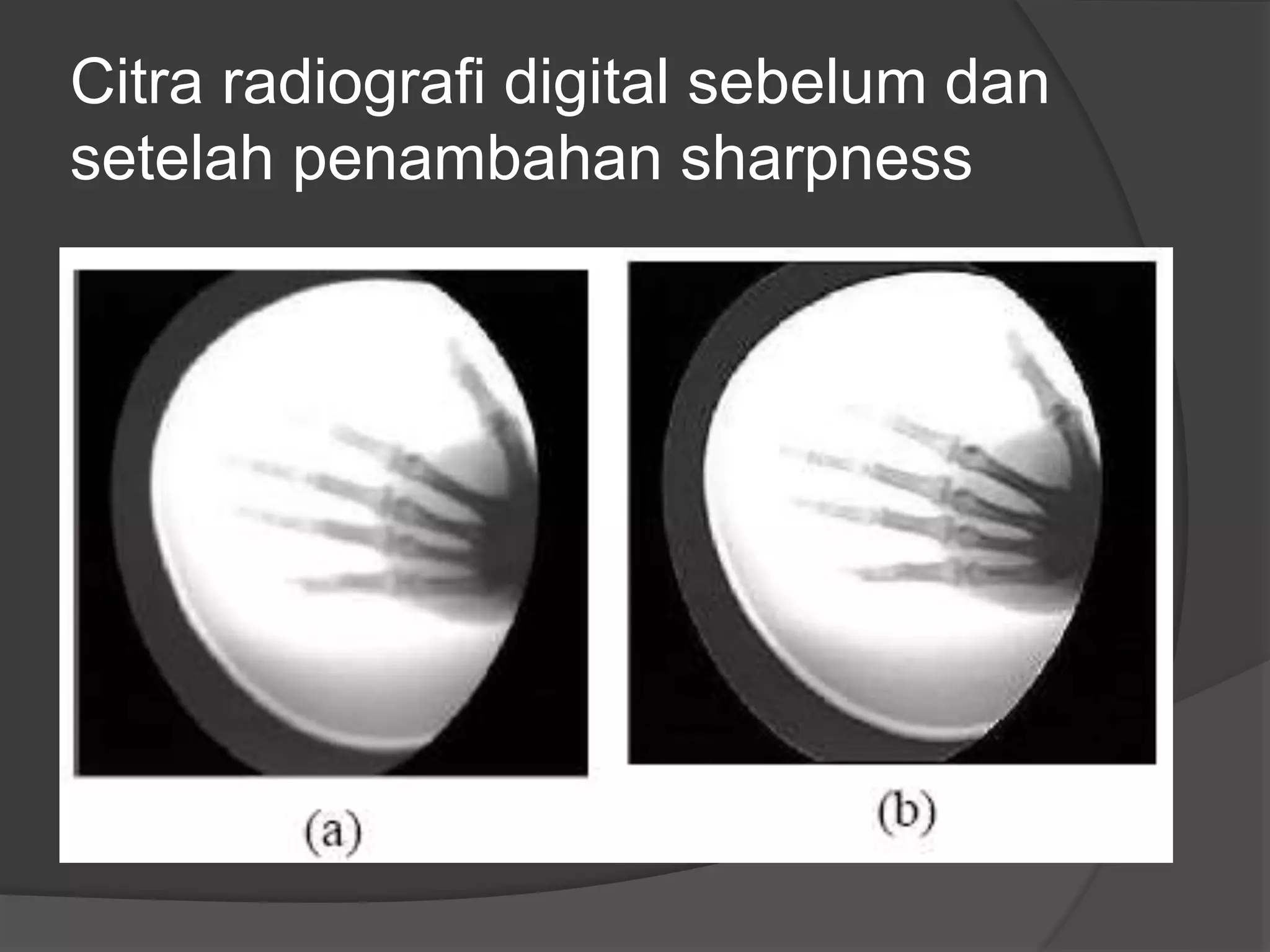 ppt Aplikasi pengolahan citra digital pada modalitas digital ...