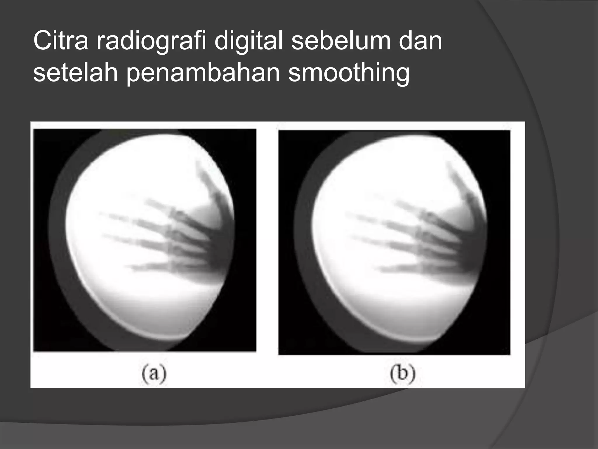 ppt Aplikasi pengolahan citra digital pada modalitas digital ...