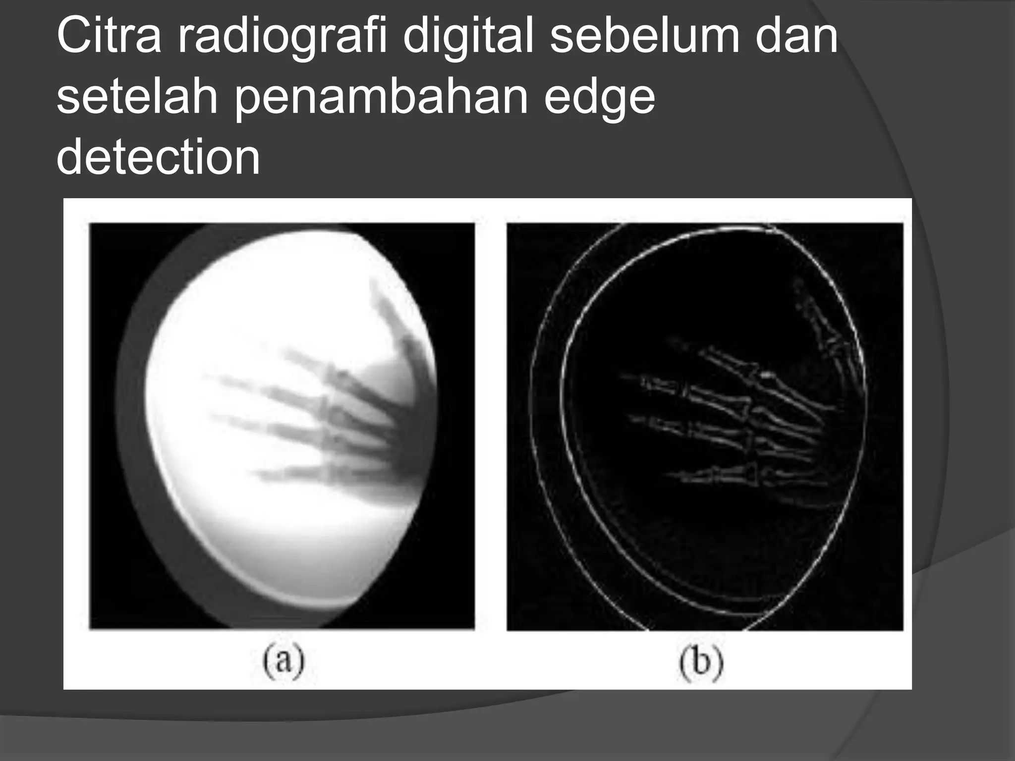 ppt Aplikasi pengolahan citra digital pada modalitas digital ...