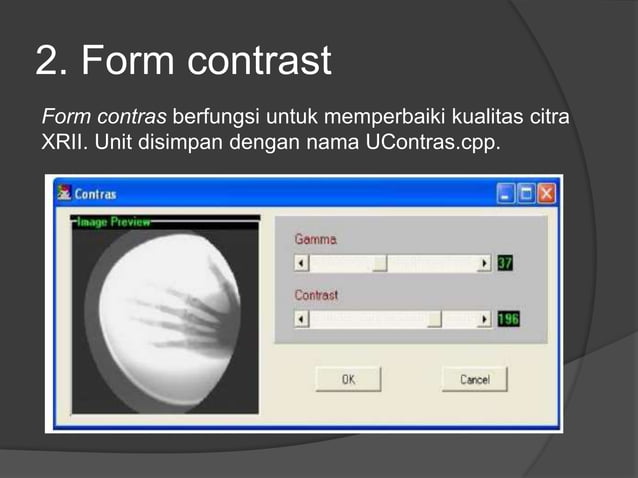 ppt Aplikasi pengolahan citra digital pada modalitas digital ...