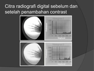 ppt Aplikasi pengolahan citra digital pada modalitas digital ...