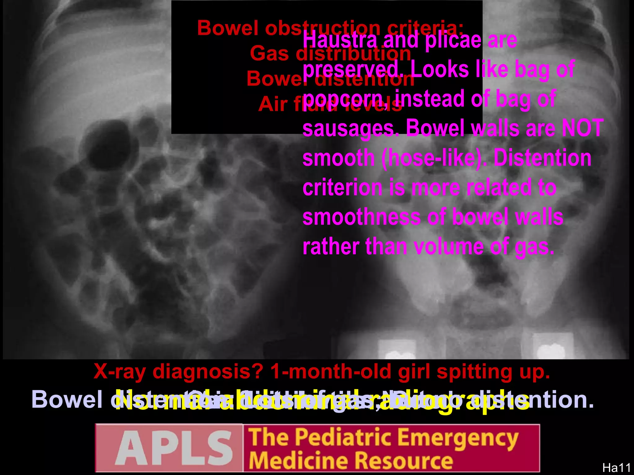 Apls Pediatric Emergency Radiology 1 | PPT