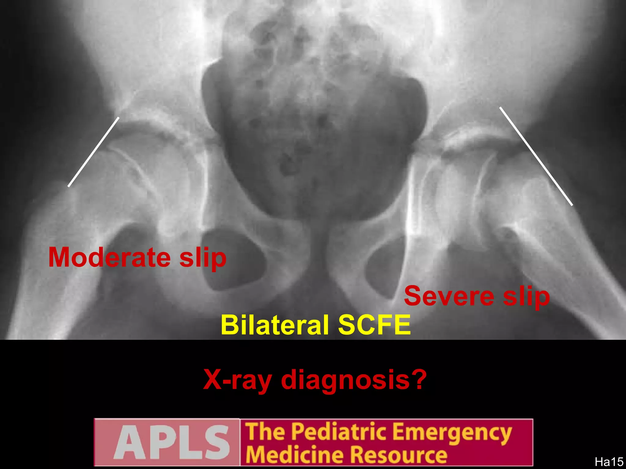 Apls Pediatric Emergency Radiology 1 | PPT