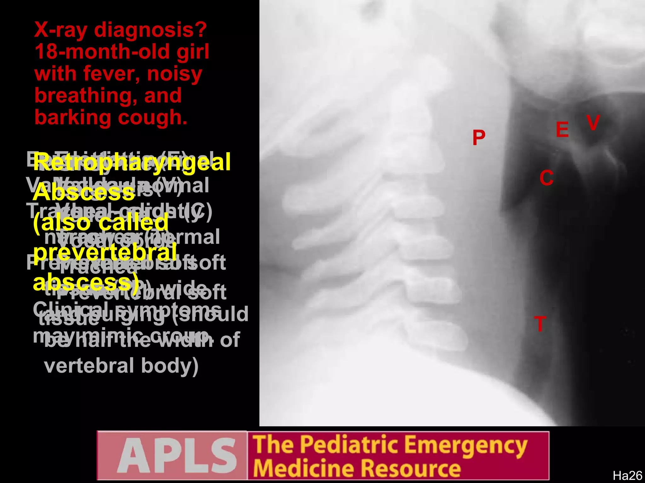 Apls Pediatric Emergency Radiology 1 | PPT