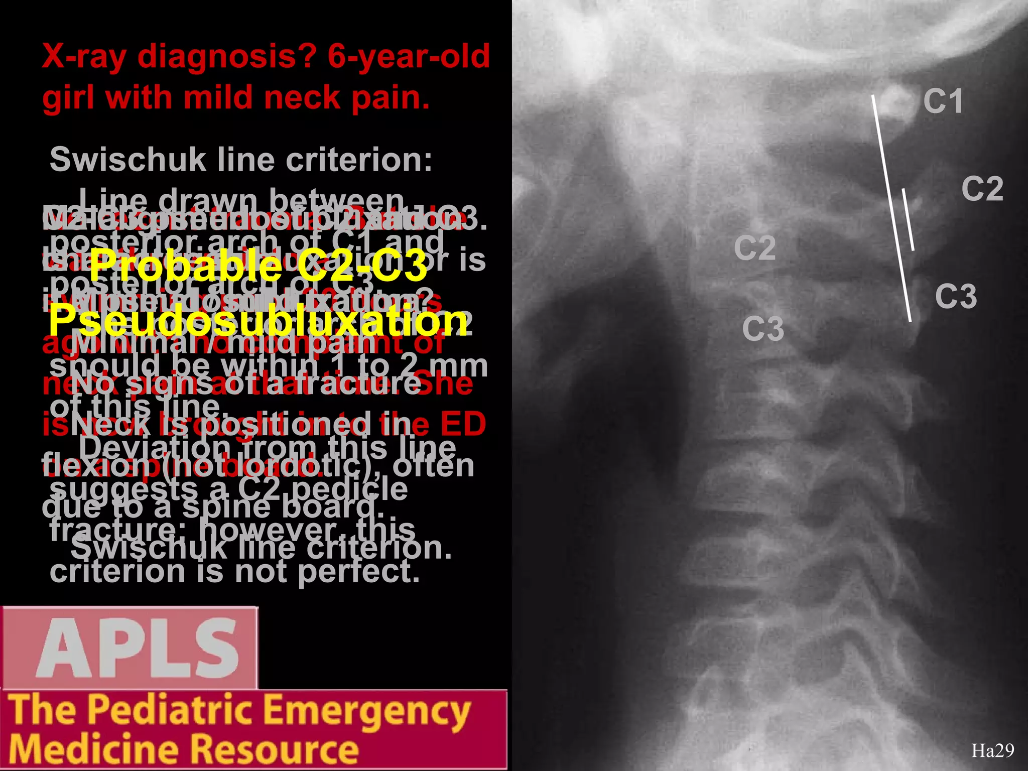 Apls Pediatric Emergency Radiology 1 | PPT
