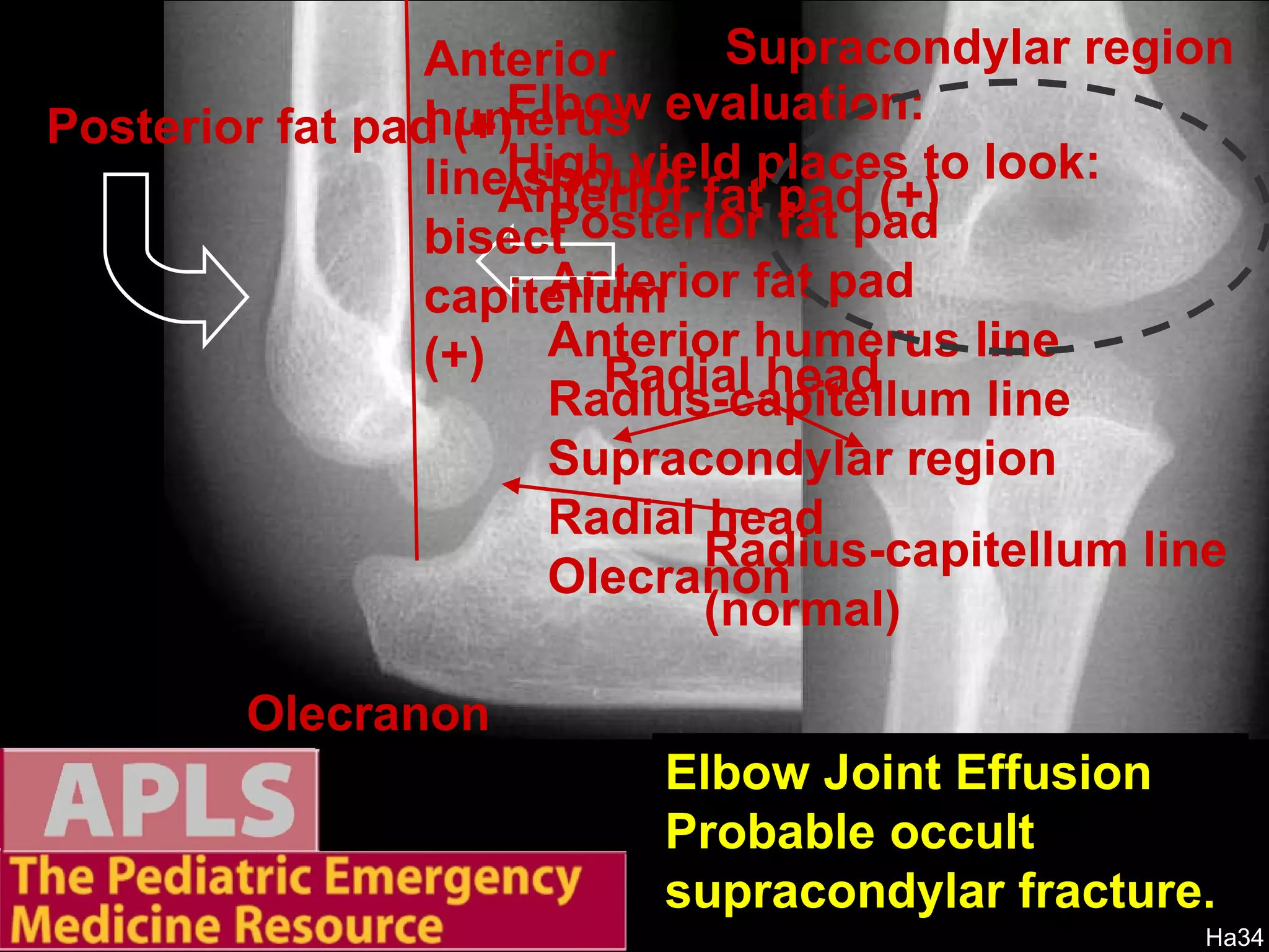 Apls Pediatric Emergency Radiology 1 | PPT