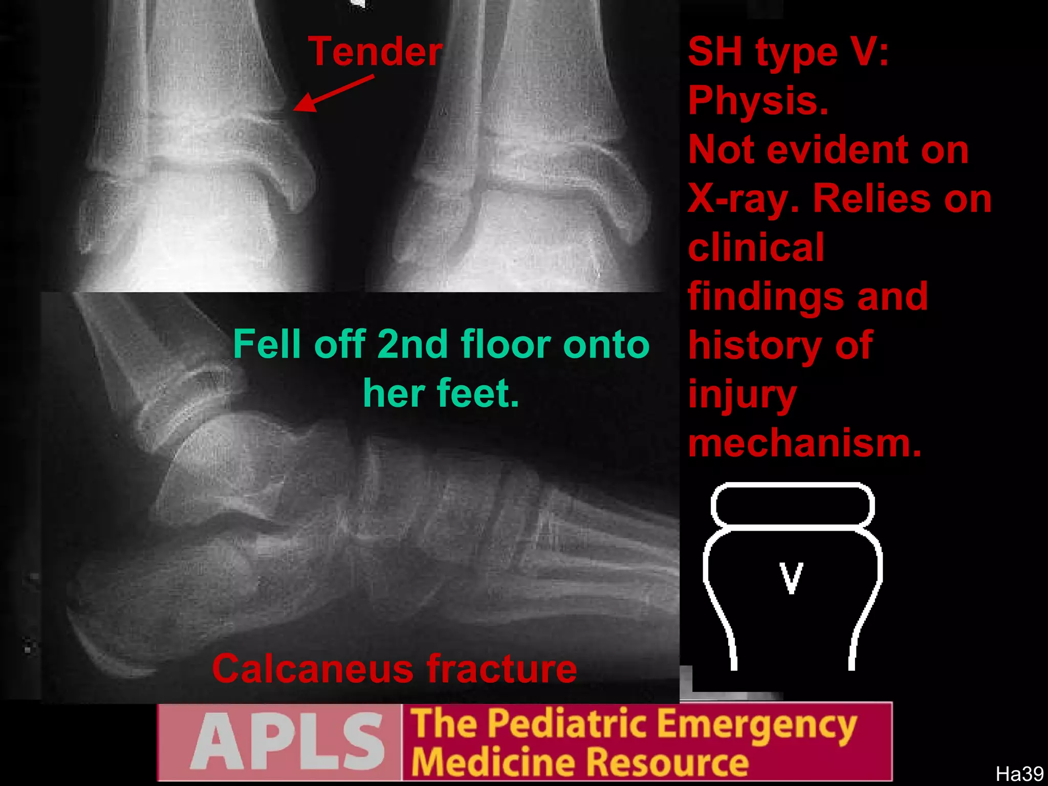 Apls Pediatric Emergency Radiology 1 | PPT
