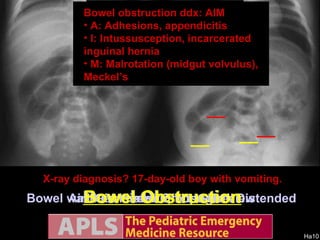Apls Pediatric Emergency Radiology 1 | PPT