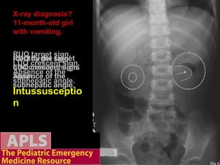Apls Pediatric Emergency Radiology 1 | PPT