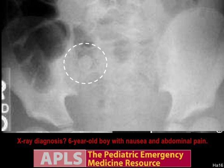 Apls Pediatric Emergency Radiology 1