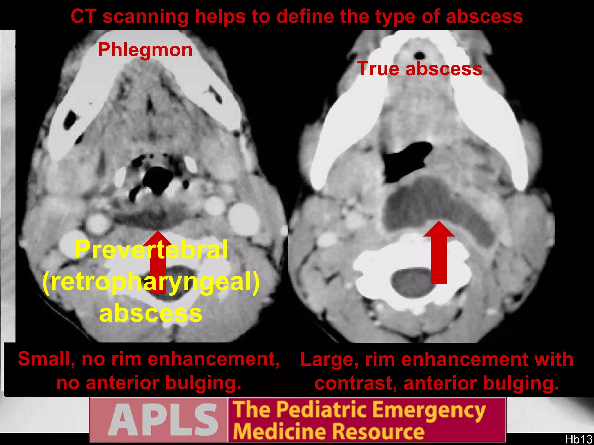 Apls Pediatric Emergency Radiology 2 | PPT