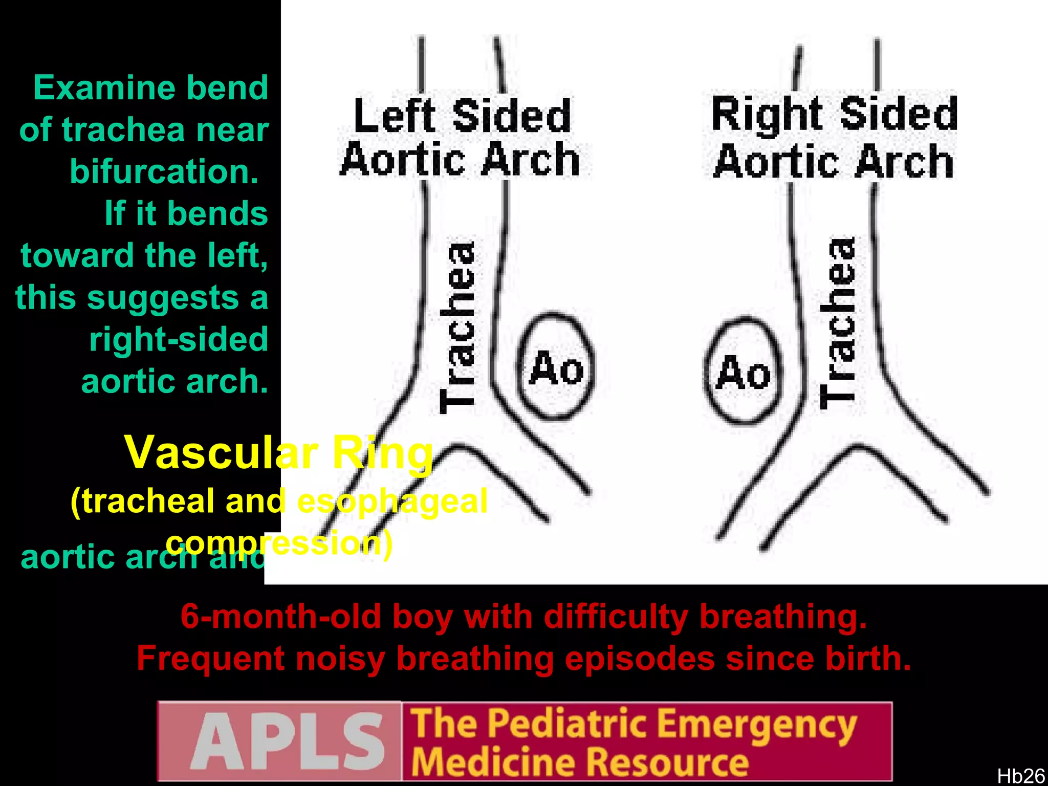 Apls Pediatric Emergency Radiology 2 | PPT