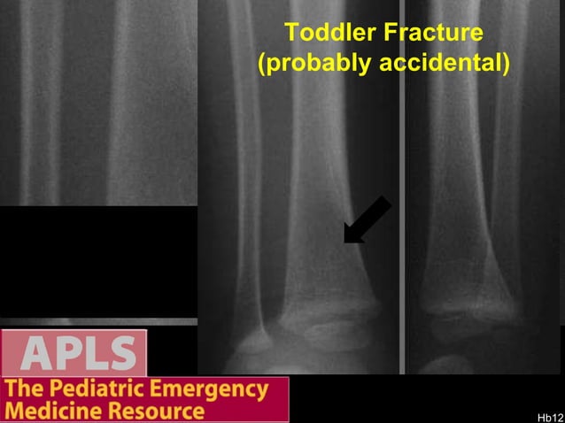 Apls Pediatric Emergency Radiology 2 | PPT