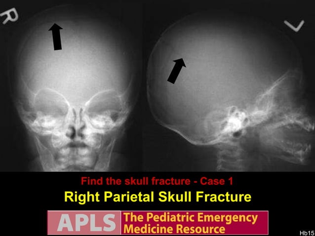 Apls Pediatric Emergency Radiology 2 | PPT