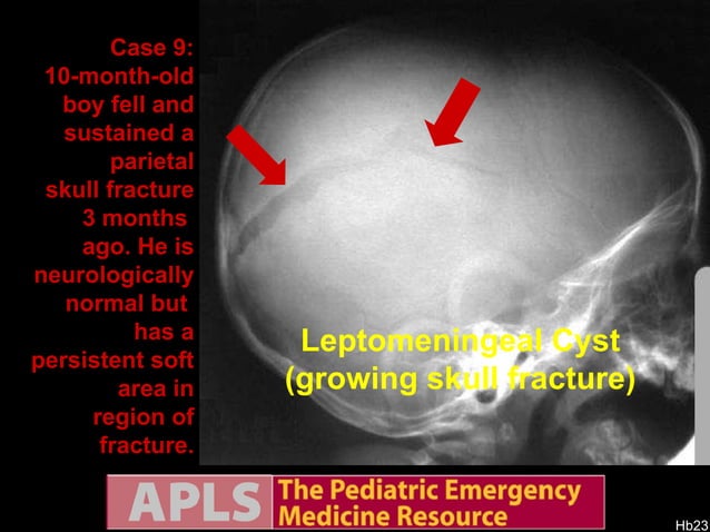 Apls Pediatric Emergency Radiology 2 | PPT
